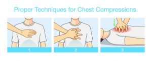 The Top 4 Most Common CPR Mistakes – Free CPR Training